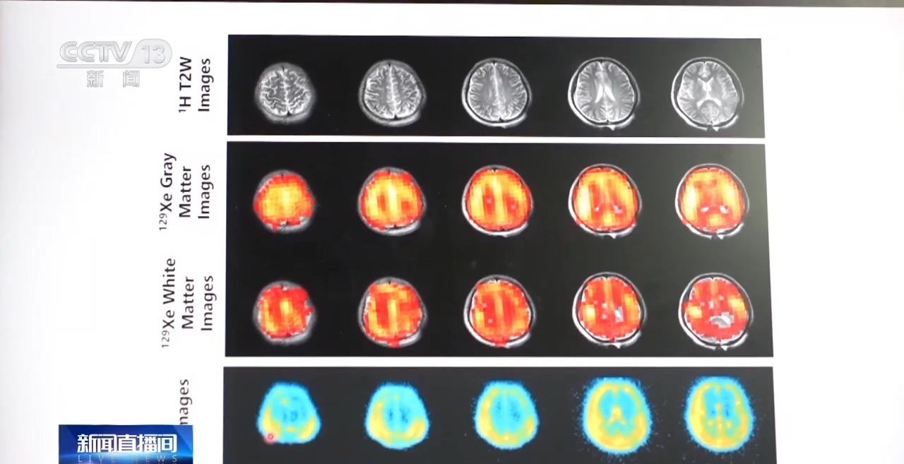中国科学院团队成功突破“多核”磁共振成像技术—新闻—科学网